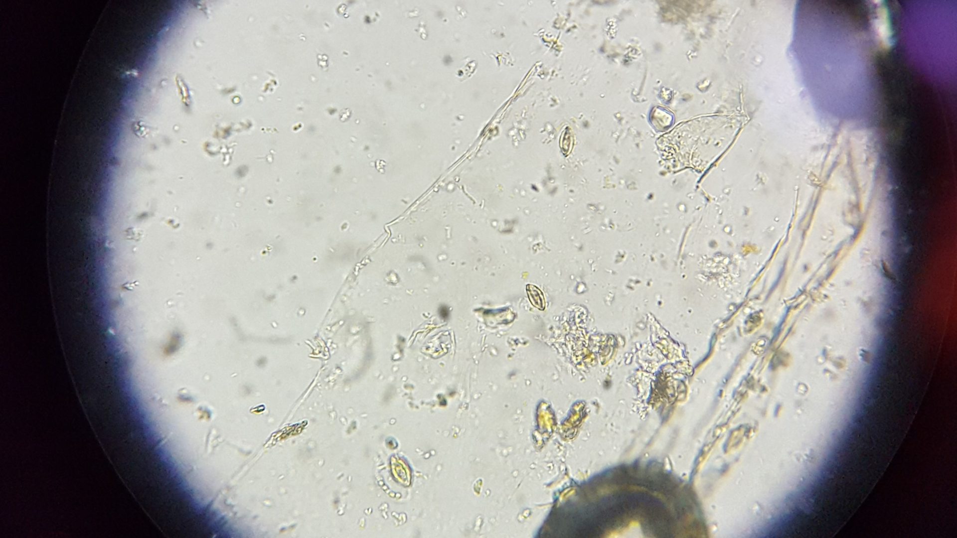 In My Classroom: POOP LAB! (AKA Fecal Floats/intestinal parasite lab)